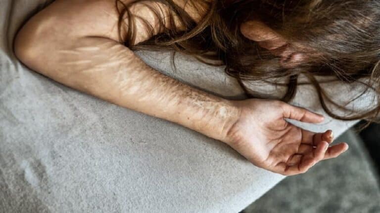 ¿Qué implica realmente la autolesión en adolescentes? Mirada profunda ...